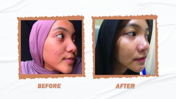 Klinik Haiza Derma - Healthy and Glow Skin is Our Priority